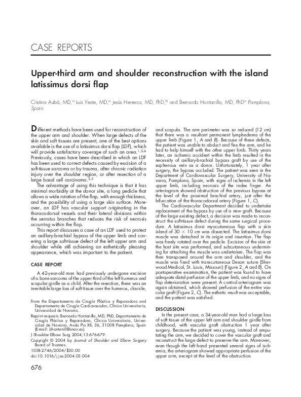 (PDF) Upper-third arm and shoulder reconstruction with the island ...