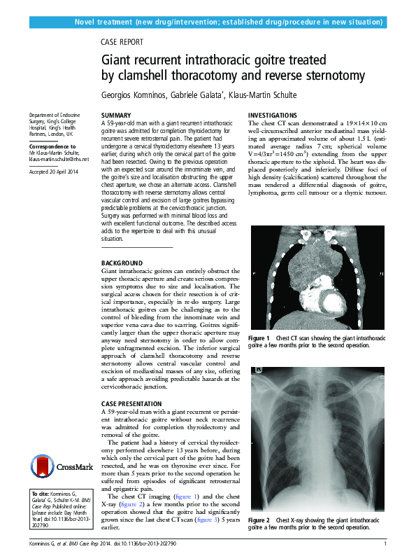 (PDF) Giant recurrent intrathoracic goitre treated by clamshell ...