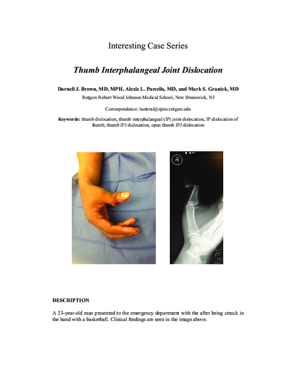 (PDF) Thumb Interphalangeal Joint Dislocation