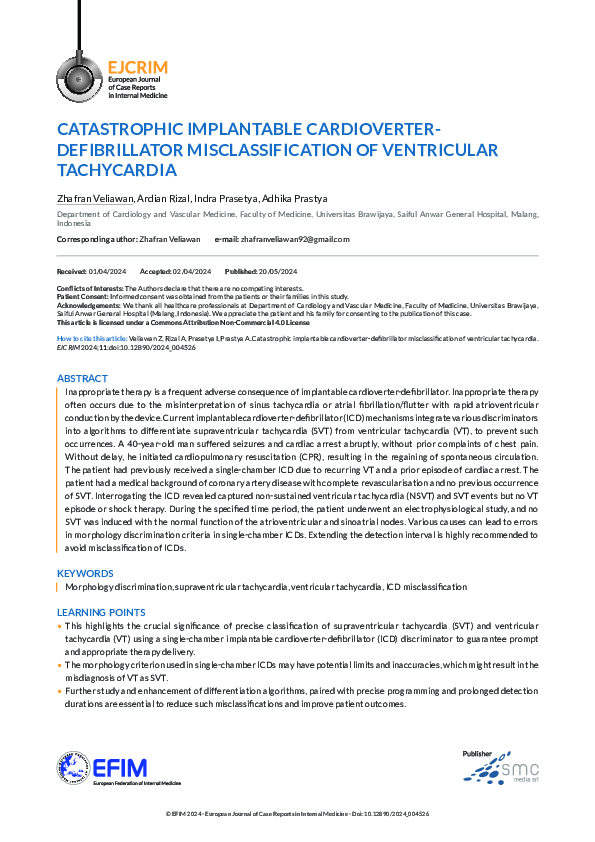 (PDF) Misclassification of Ventricular Tachycardia in ICDs