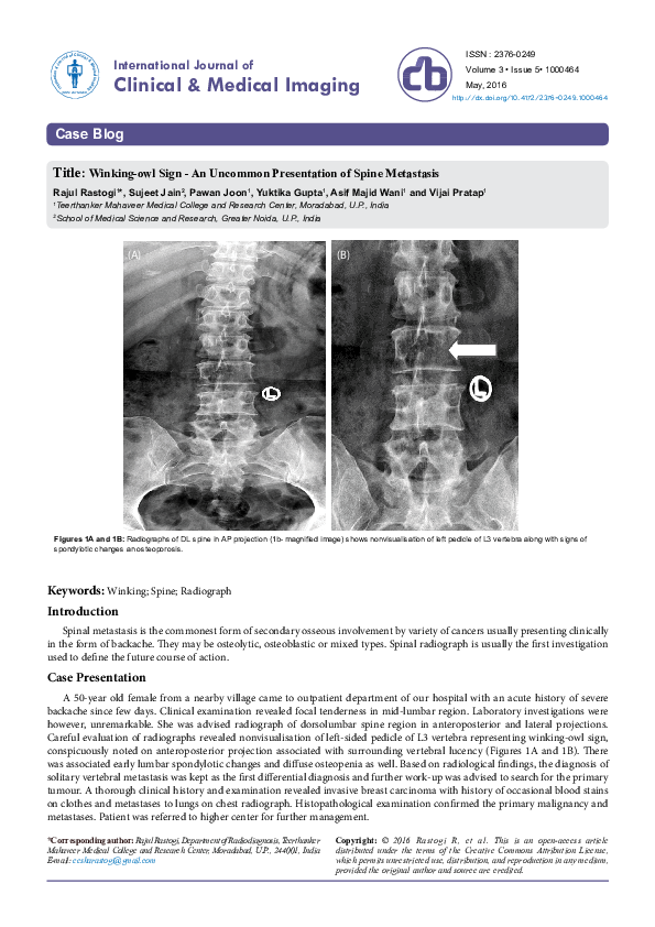 (PDF) Winking-owl Sign - An Uncommon Presentation of Spine Metastasis ...