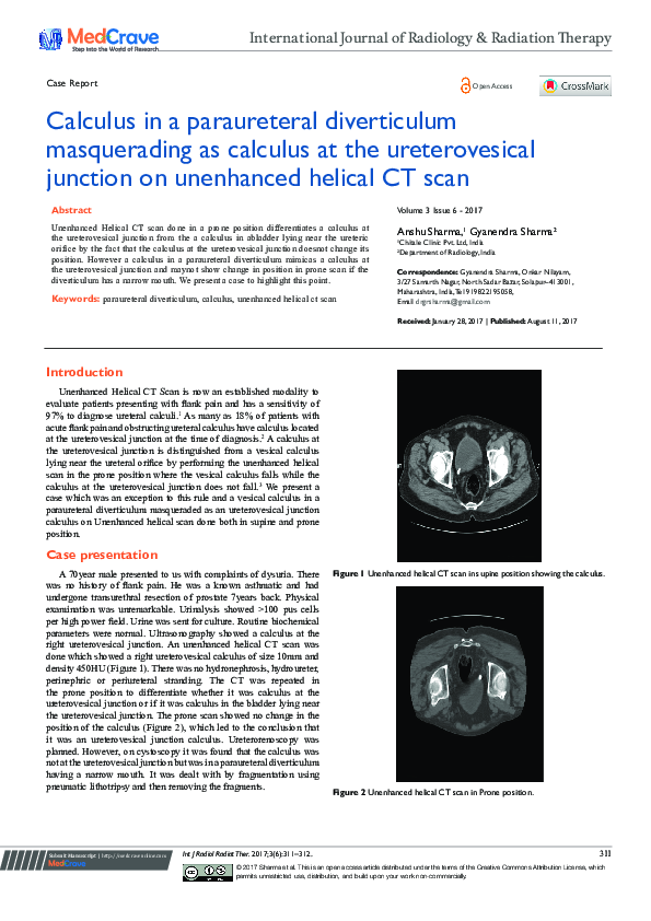 (PDF) Calculus in a Paraureteral Diverticulum Masquerading as Calculus ...