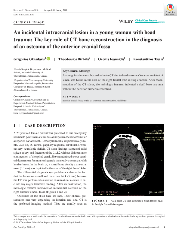 (PDF) An incidental intracranial lesion in a young woman with head ...