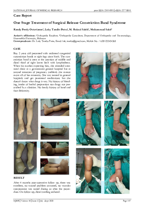 (PDF) ONE STAGE TREATMENT OF SURGICAL RELEASE CONSTRICTION BAND SYNDROME