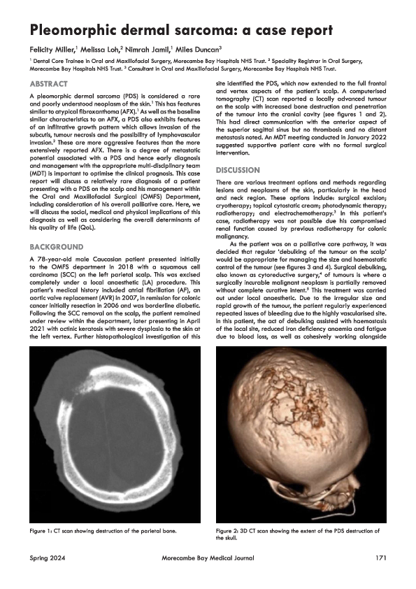 (PDF) Pleomorphic dermal sarcoma: a case report | Nimrah Jamil ...