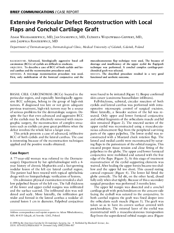 (PDF) Extensive Periocular Defect Reconstruction with Local Flaps and ...