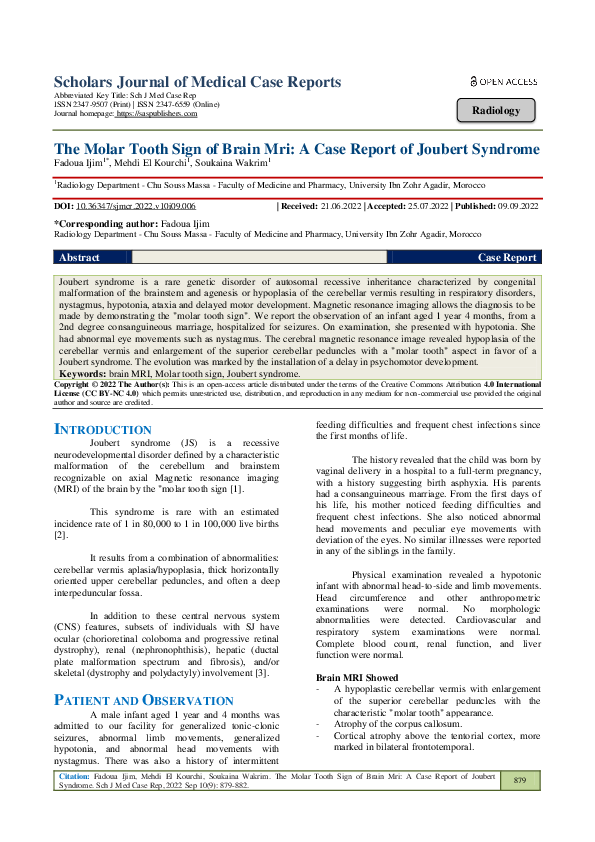 (PDF) The Molar Tooth Sign of Brain Mri: A Case Report of Joubert Syndrome