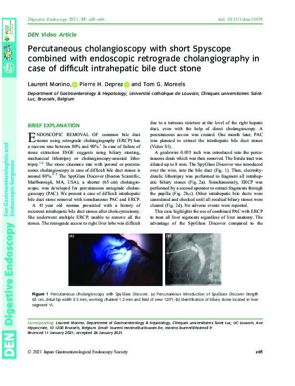 (PDF) Percutaneous cholangioscopy with short Spyscope combined with ...