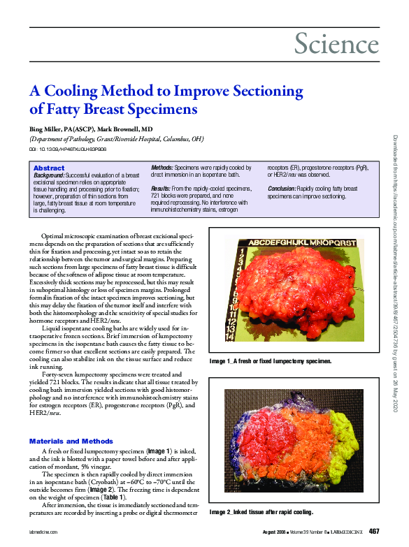 (PDF) A Cooling Method to Improve Sectioning of Fatty Breast Specimens