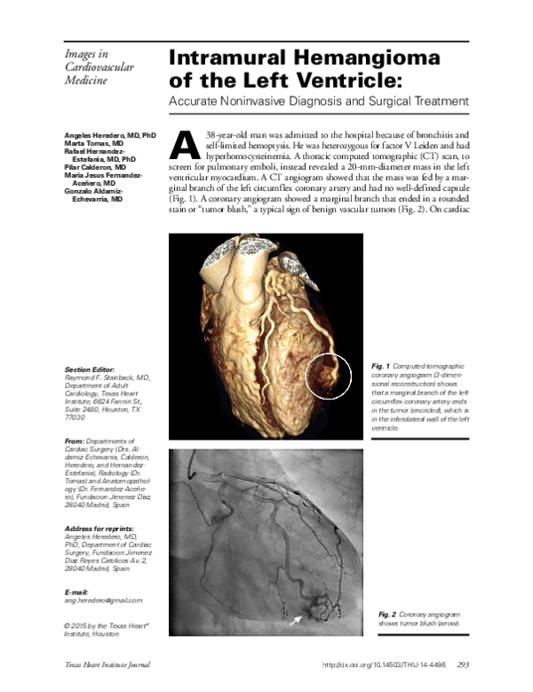 (PDF) Intramural Hemangioma of the Left Ventricle: Accurate Noninvasive ...