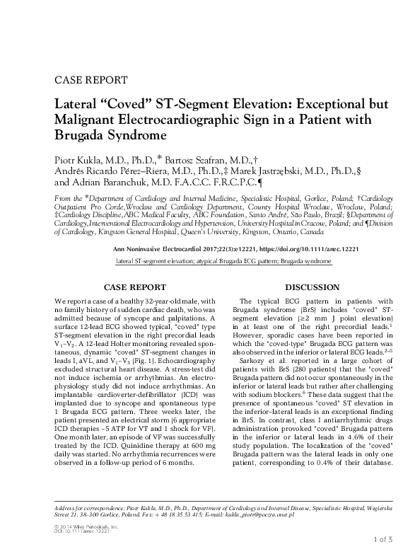 (PDF) Lateral “Coved” ST-Segment Elevation: Exceptional but Malignant ...