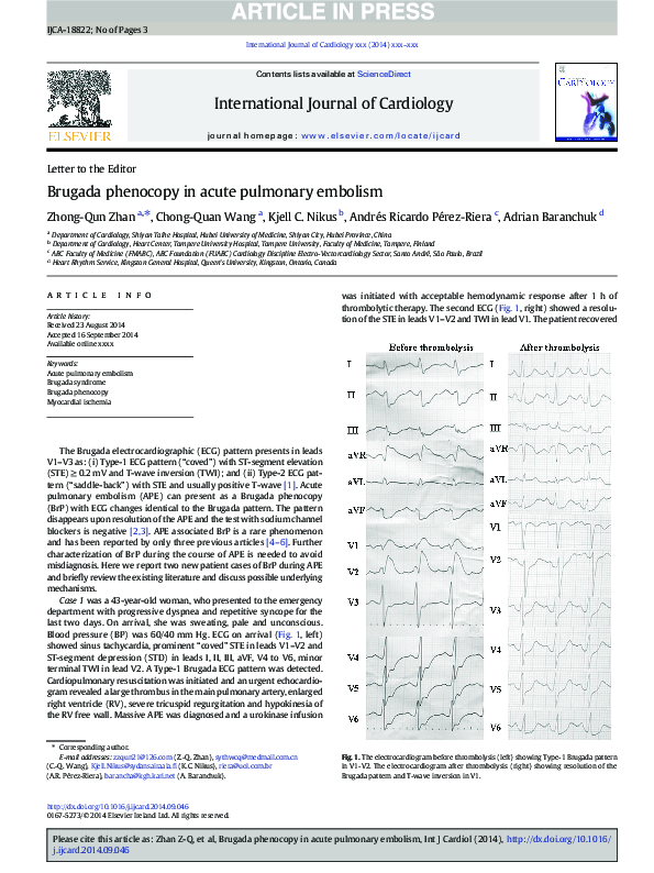 (PDF) Brugada phenocopy in acute pulmonary embolism