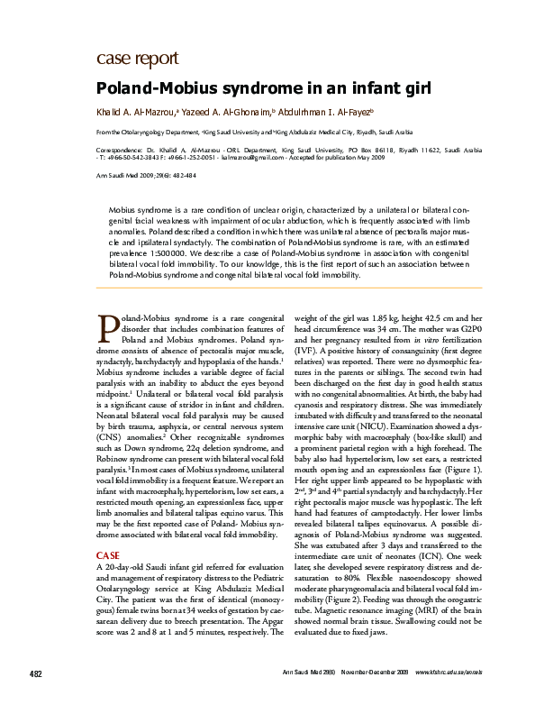 (PDF) Poland-Mobius syndrome in an infant girl
