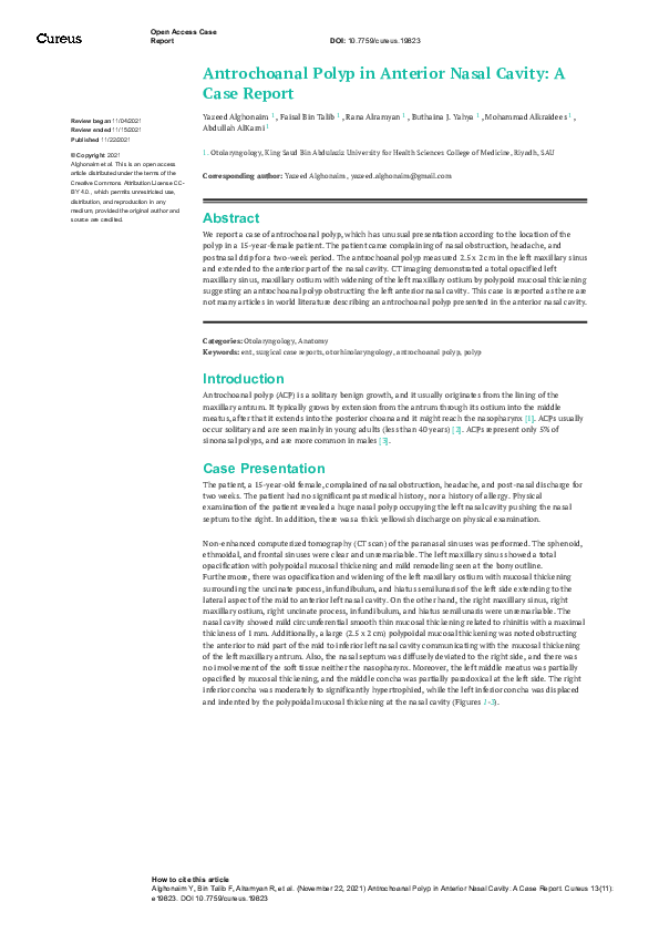 (PDF) Antrochoanal Polyp in Anterior Nasal Cavity: A Case Report