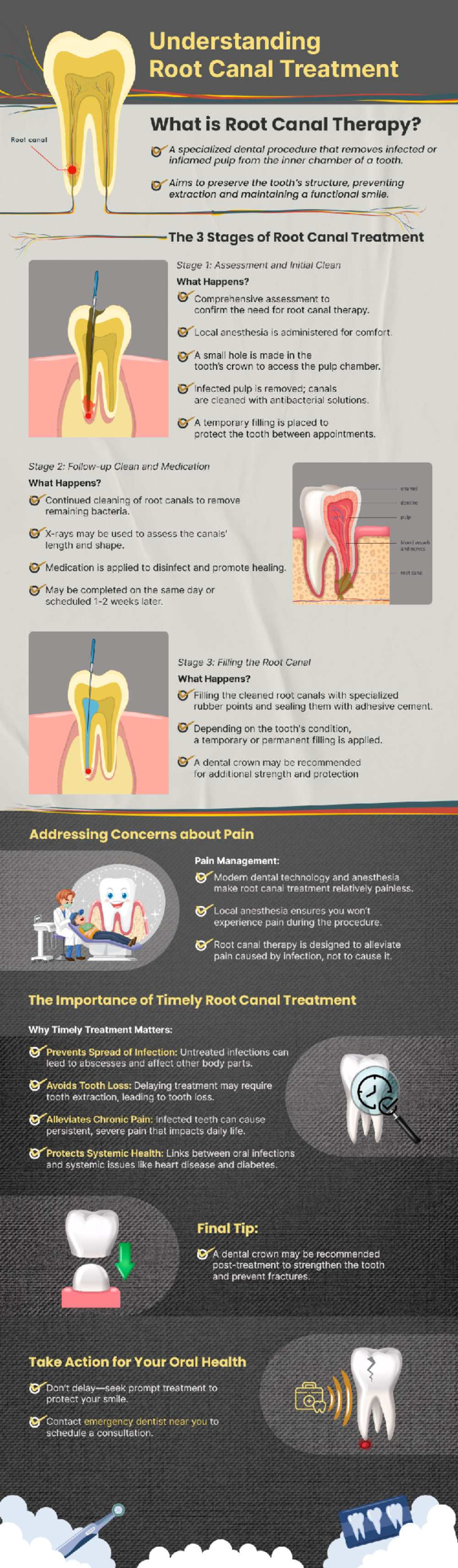 (PDF) Understanding Root Canal Treatment