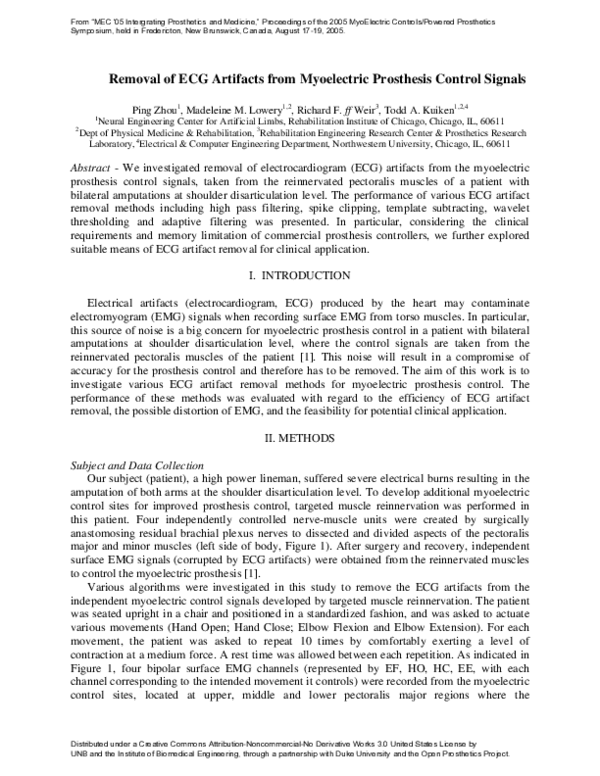 (PDF) Removal of ECG Artifacts from Myoelectric Prosthesis Control Signals
