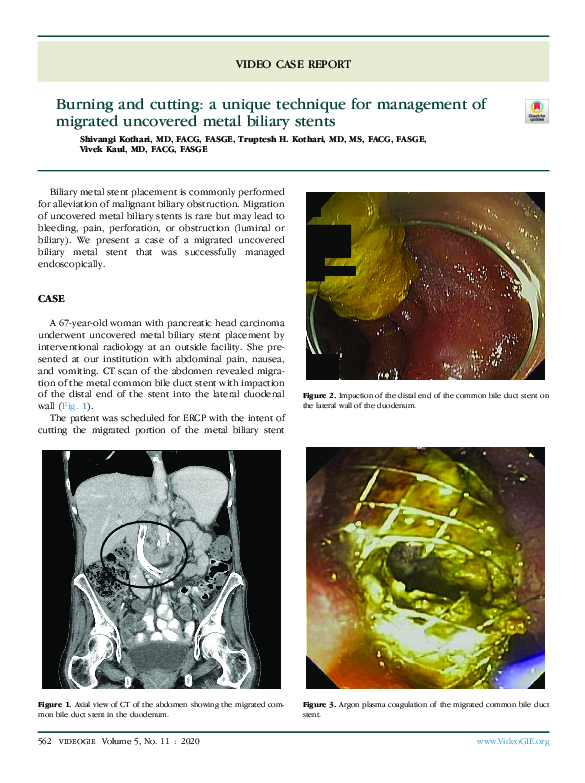 (PDF) Burning and cutting: a unique technique for management of ...