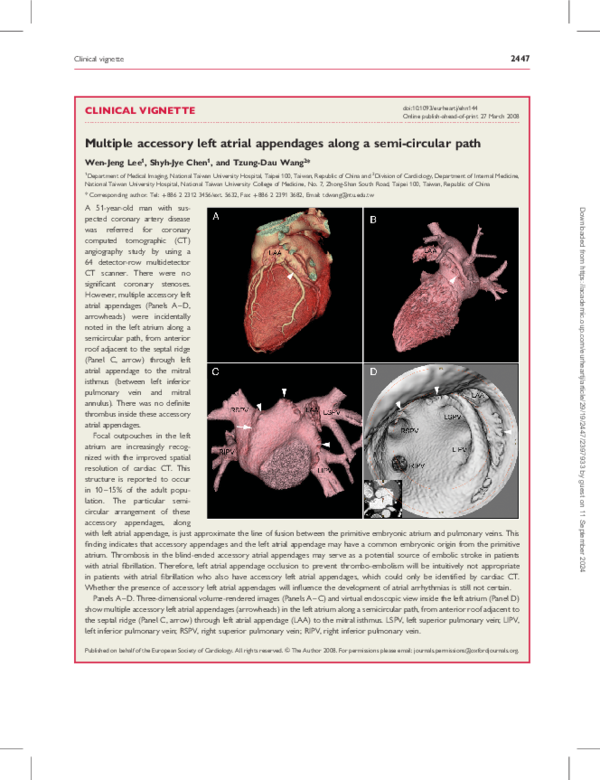 (PDF) Multiple accessory left atrial appendages along a semi-circular path