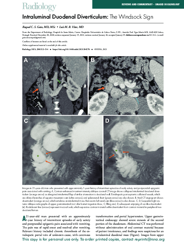 (PDF) Intraluminal Duodenal Diverticulum: The Windsock Sign