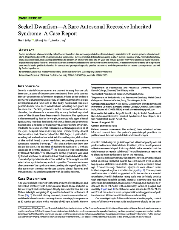 (PDF) Seckel Dwarfism—A Rare Autosomal Recessive Inherited Syndrome: A ...