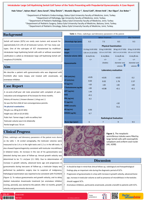 (PDF) Intratubular large cell hyalinizing Sertoli cell tumor of the ...