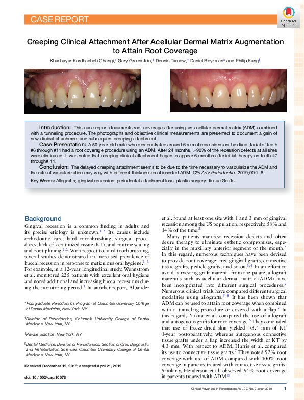 (PDF) Creeping Clinical Attachment After Acellular Dermal Matrix ...