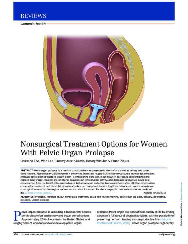 (PDF) Nonsurgical Treatment Options for Women With Pelvic Organ Prolapse