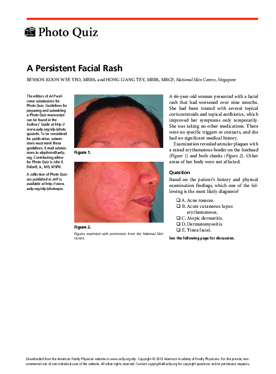 (PDF) A persistent facial rash