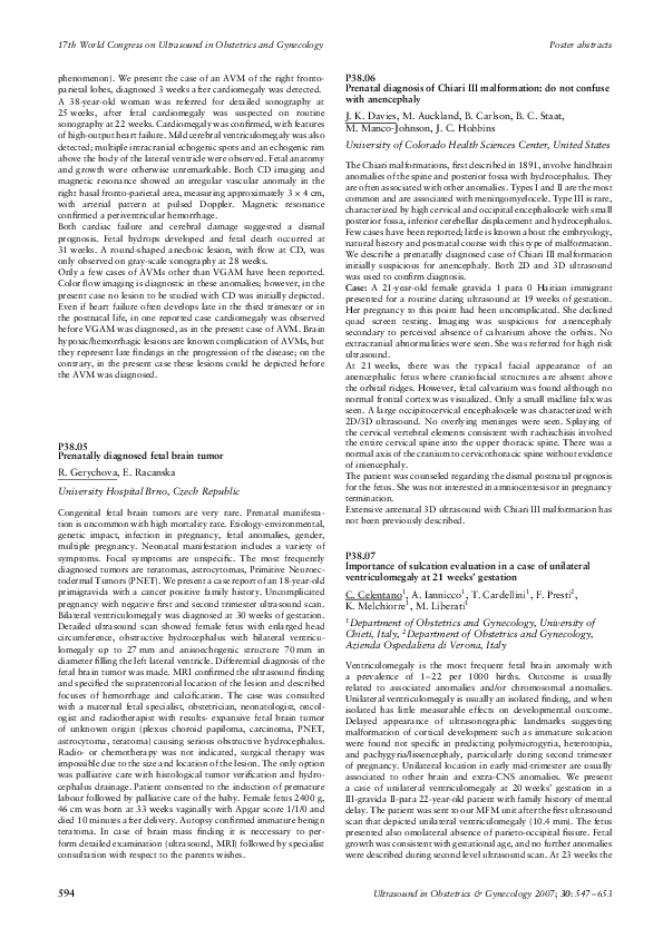 (PDF) P38.07: Importance of sulcation evaluation in a case of ...