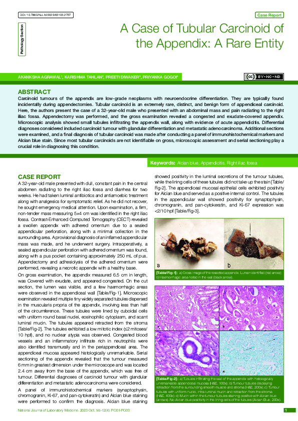 (PDF) A Case of Tubular Carcinoid of the Appendix: A Rare Entity