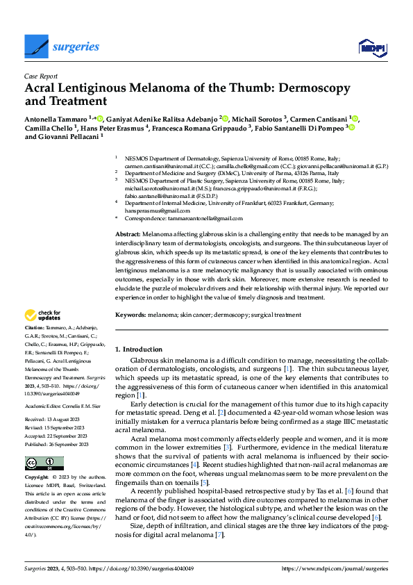 (PDF) Acral Lentiginous Melanoma of the Thumb: Dermoscopy and Treatment