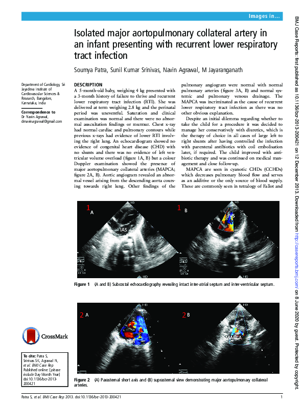 (PDF) Isolated major aortopulmonary collateral artery in an infant ...