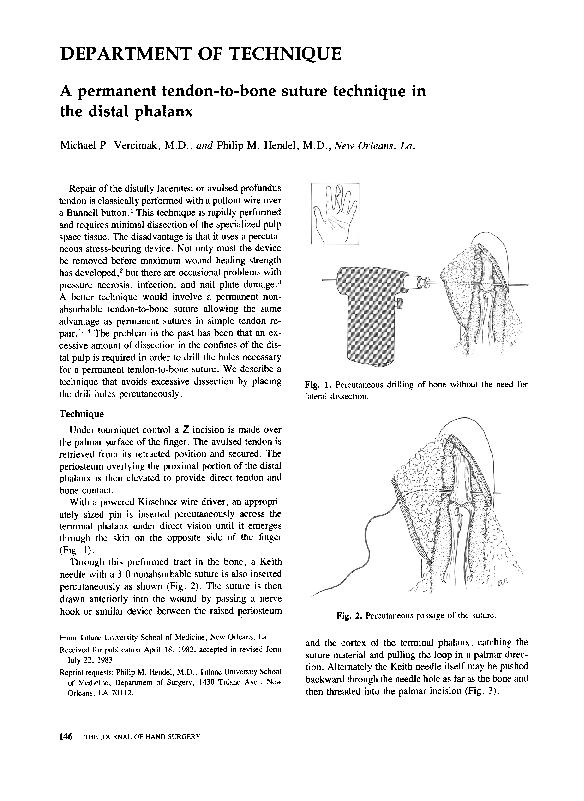 (PDF) A permanent tendon-to-bone suture technique in the distal phalanx