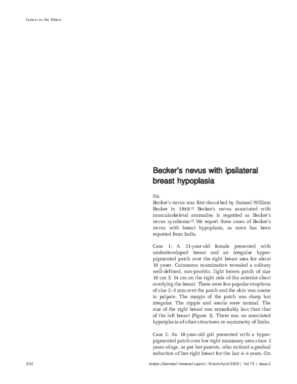 (PDF) Becker's nevus with ipsilateral breast hypoplasia