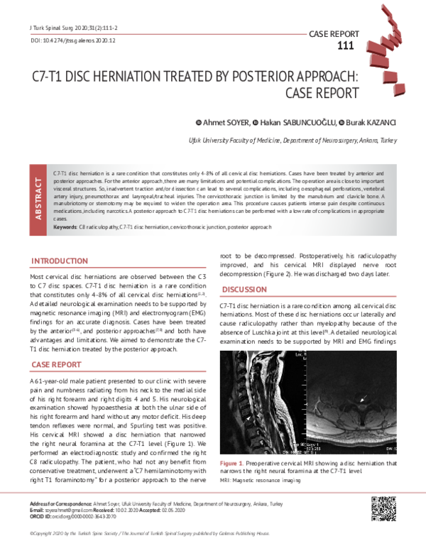 (PDF) C7-T1 Disc Herniation Treated by Posterior Approach: Case Report