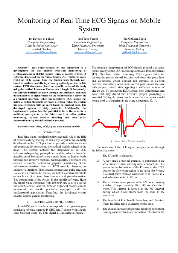 Pdf Real Time Ecg Monitoring Via Mobile System With Alerts