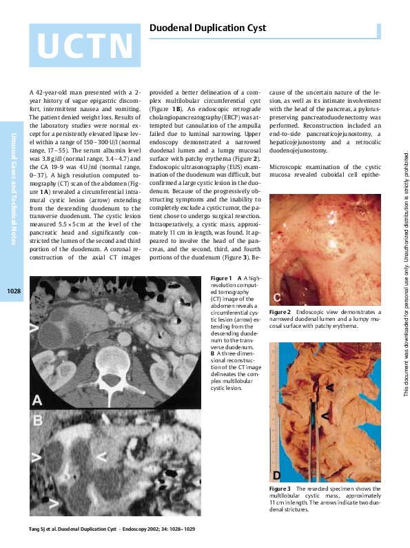 (PDF) Duodenal Duplication Cyst | Rudolph Bedford - Academia.edu