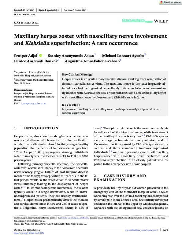 (PDF) Maxillary herpes zoster with nasociliary nerve involvement and ...