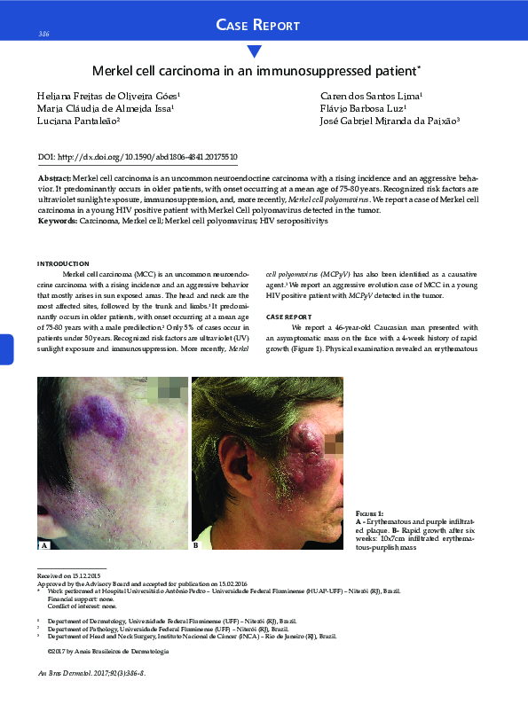 (PDF) Merkel cell carcinoma in an immunosuppressed patient | Flávio Luz ...