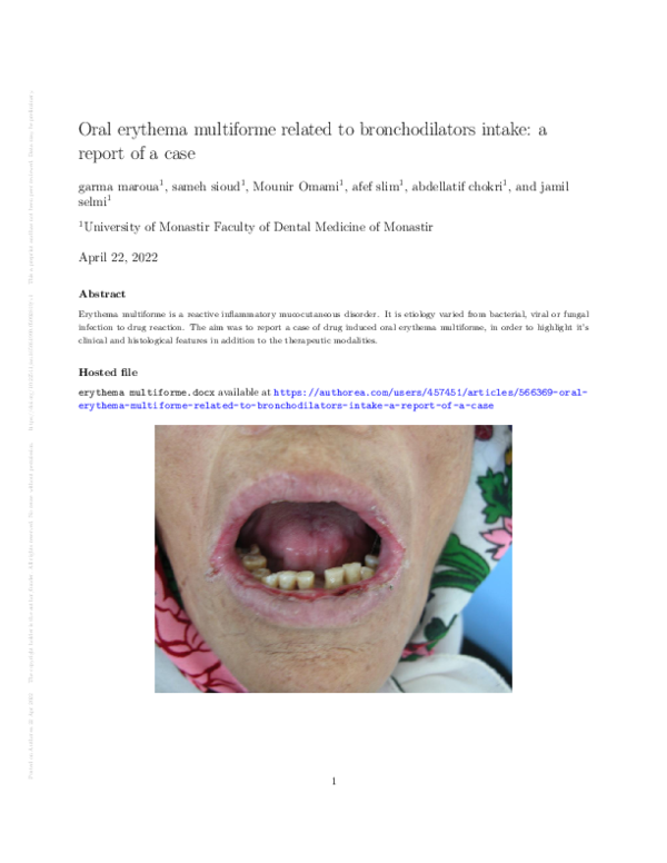 (PDF) Oral erythema multiforme related to bronchodilators intake: a ...