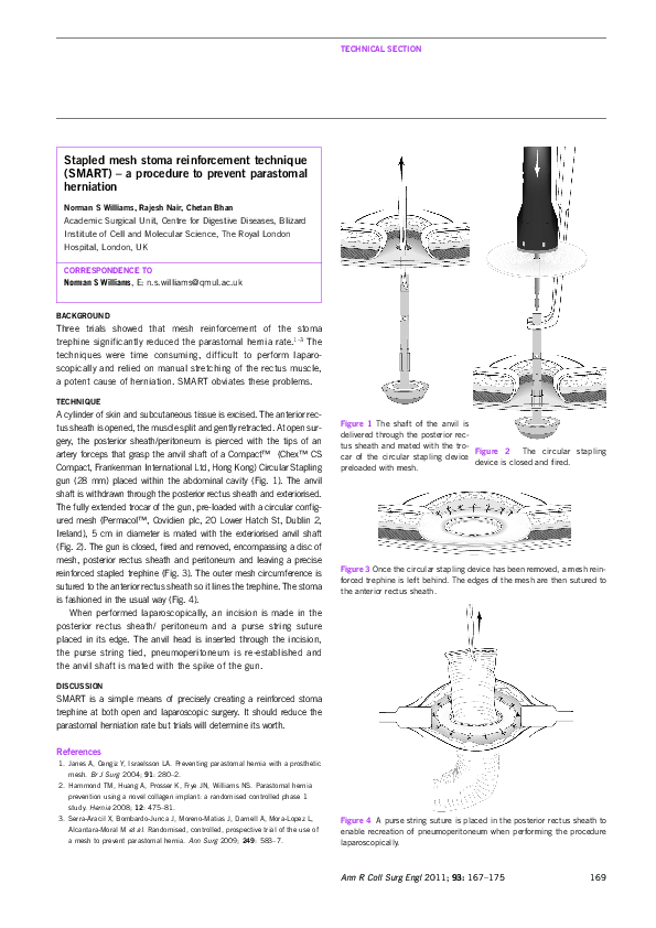 (PDF) Stapled mesh stoma reinforcement technique (SMART) for use in ...