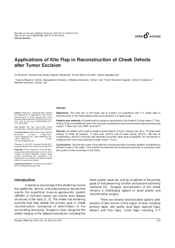 (PDF) Applications of Kite Flap in Reconstruction of Cheek Defects ...