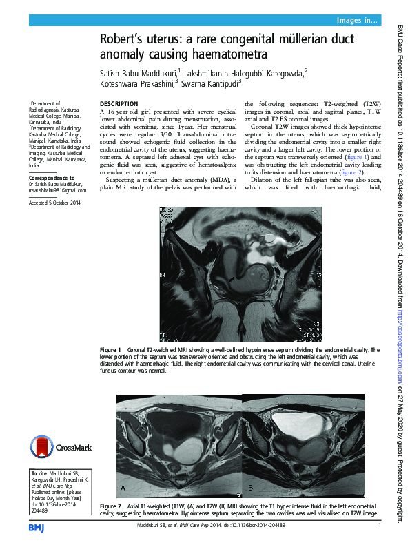 (PDF) Robert's uterus: a rare congenital mullerian duct anomaly causing ...