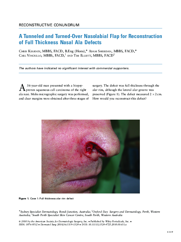 (PDF) A Tunneled and Turned-Over Nasolabial Flap for Reconstruction of ...