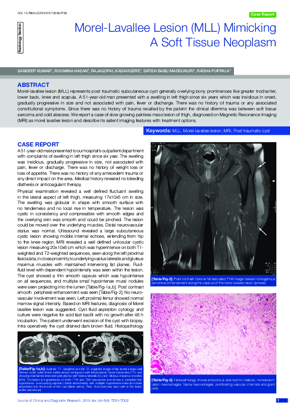 (PDF) Morel-Lavallee Lesion (MLL) Mimicking A Soft Tissue Neoplasm