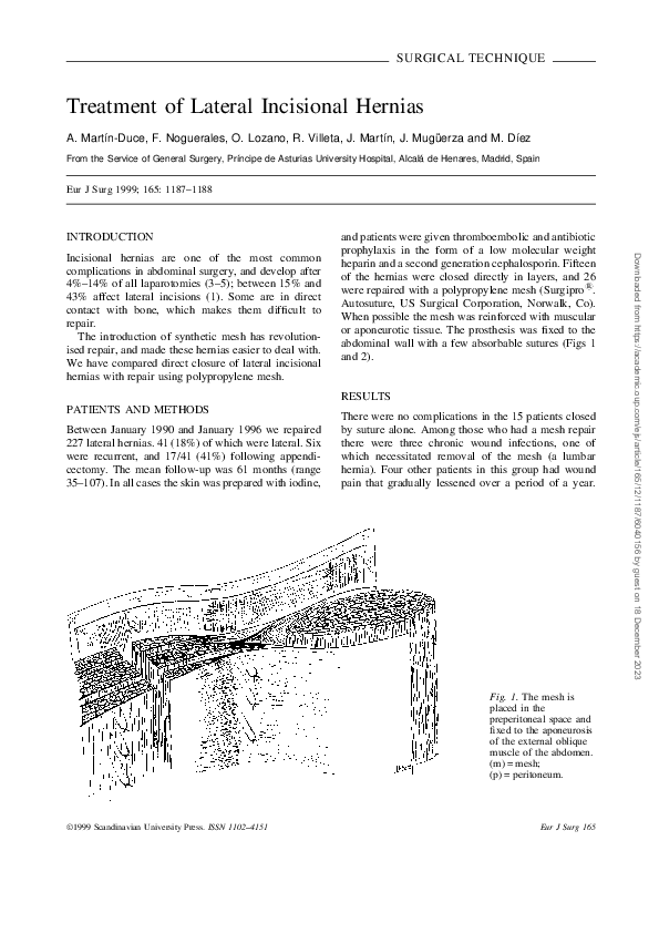 (PDF) Treatment of Lateral Incisional Hernias
