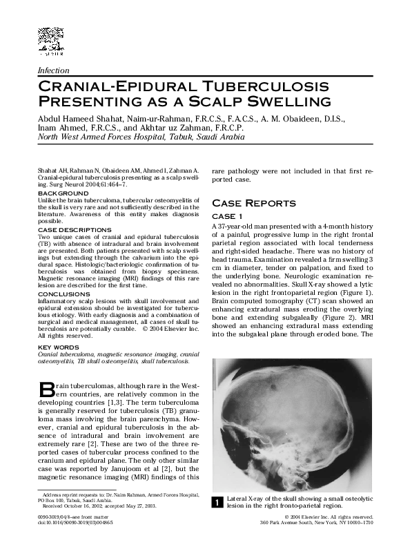(PDF) Cranial-epidural tuberculosis presenting as a scalp swelling ...