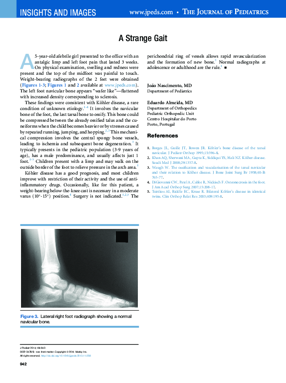 (PDF) A Strange Gait