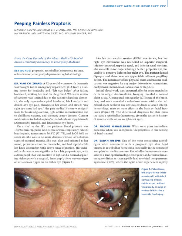 (PDF) Peeping Painless Proptosis