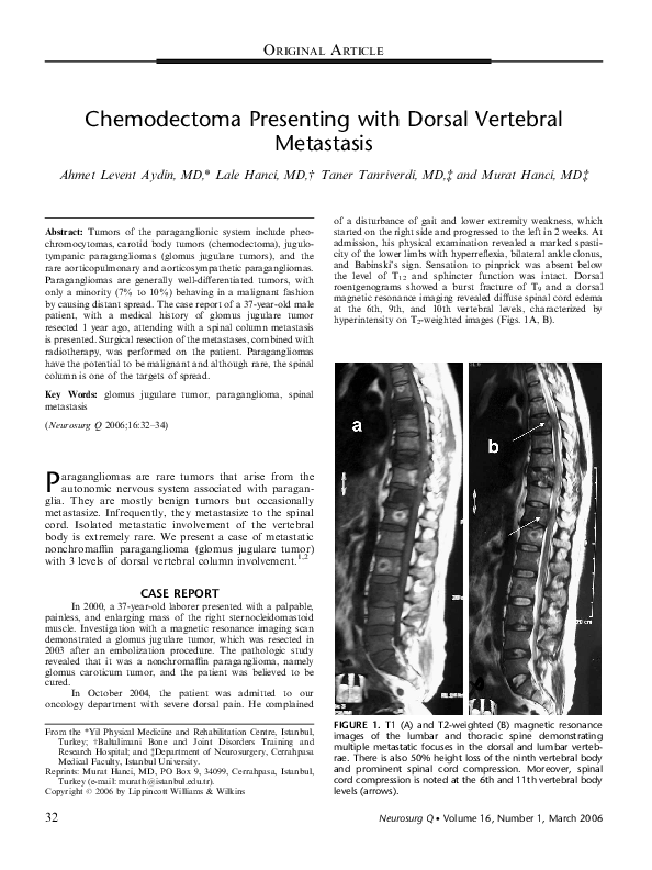 (PDF) Chemodectoma Presenting with Dorsal Vertebral Metastasis